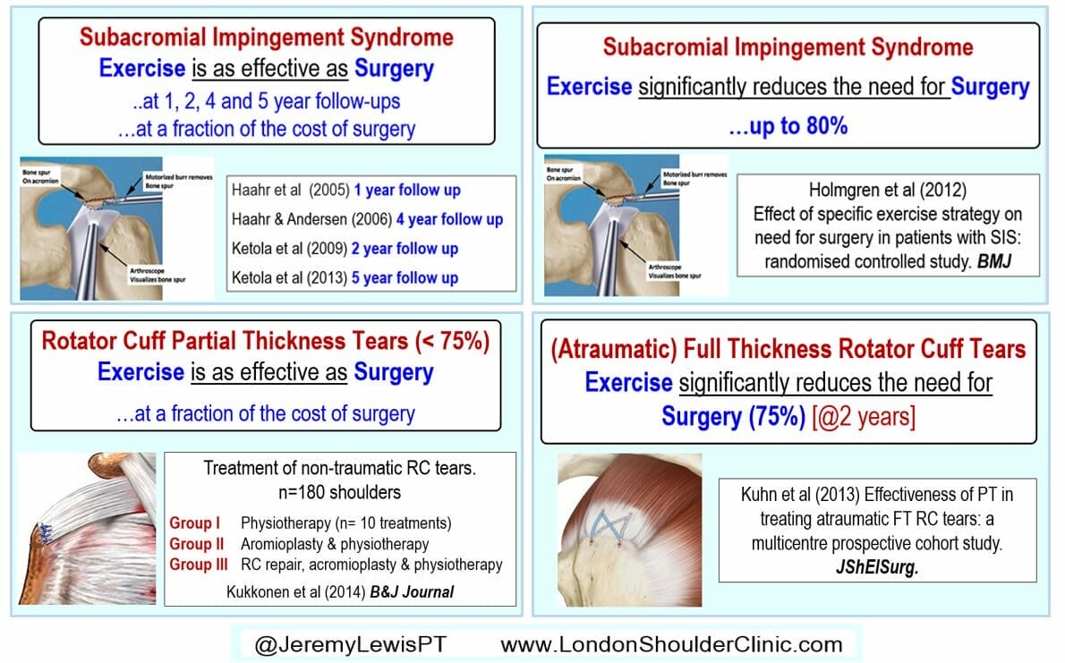 Rotator Cuff Rehab: Strengthening exercises - Physio Prescription